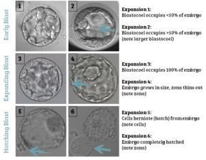 IVF Embryo Grades Explained (3AA, 5CC, 4BB + Success Rates)