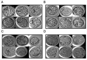 IVF Embryo Grades Explained (3AA, 5CC, 4BB + Success Rates)