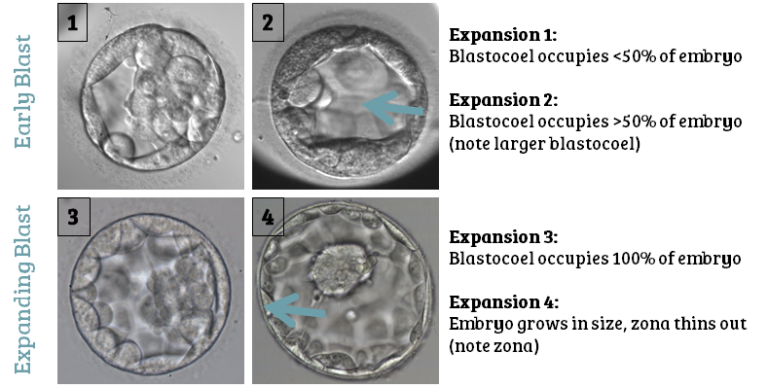Embryo biopsy of small embryos dramatically reduces IVF success rates ...