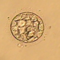 Embryo Gallery | Remembryo
