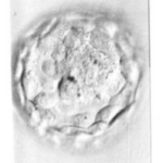 Embryo Gallery | Remembryo