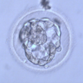 Embryo Gallery | Remembryo