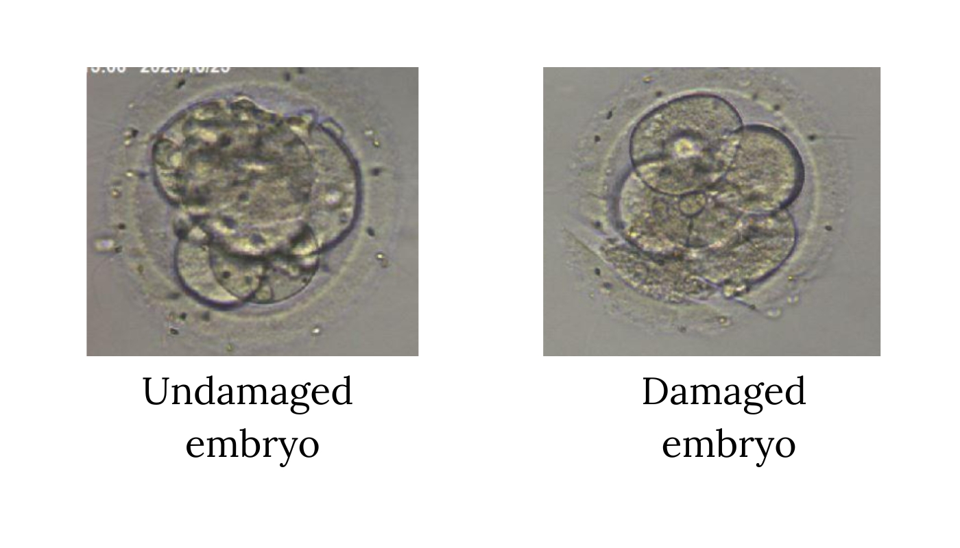 Frozen embryos damaged after excessive bending of cryostorage device ...