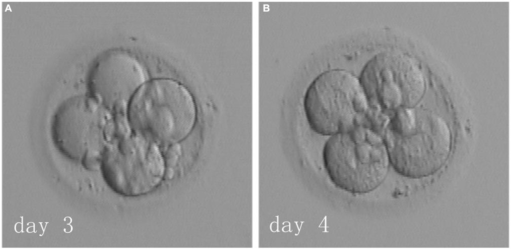 Unlikely 4 cell embryo results in live birth | Remembryo