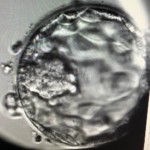 Embryo Gallery - Remembryo
